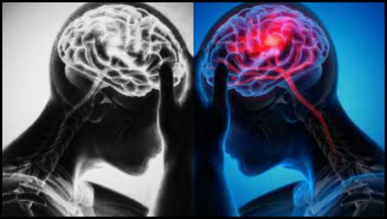 Top Scientist: Faulty Brain Wire Causes Ear Ringing - Tinnitus Cure Guide